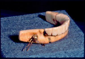 False Teeth in the 18th Century | Jane Austen's World