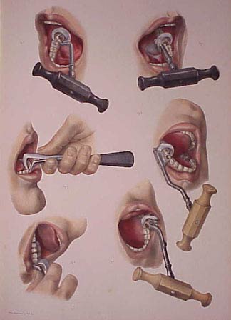 Dentistry During Jane Austen’s Era | Jane Austen's World